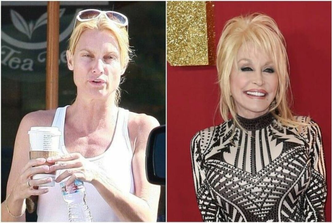 NashvilleGab - Dolly Parton With No Wig (Behind the Glamour)